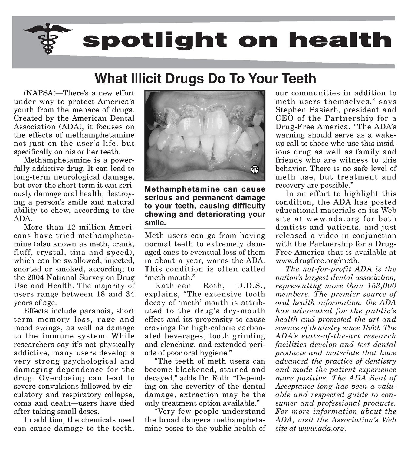 What Illicit Drugs Do To Your Teeth | North American Precis Syndicate, Inc.